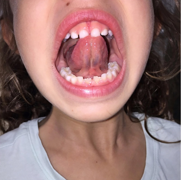 Pediatric ENT | Florida E.N.T. & Allergy